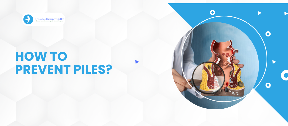 Piles Doctor in Bangalore | Constipation and Piles | Dr. Manas Tripathy